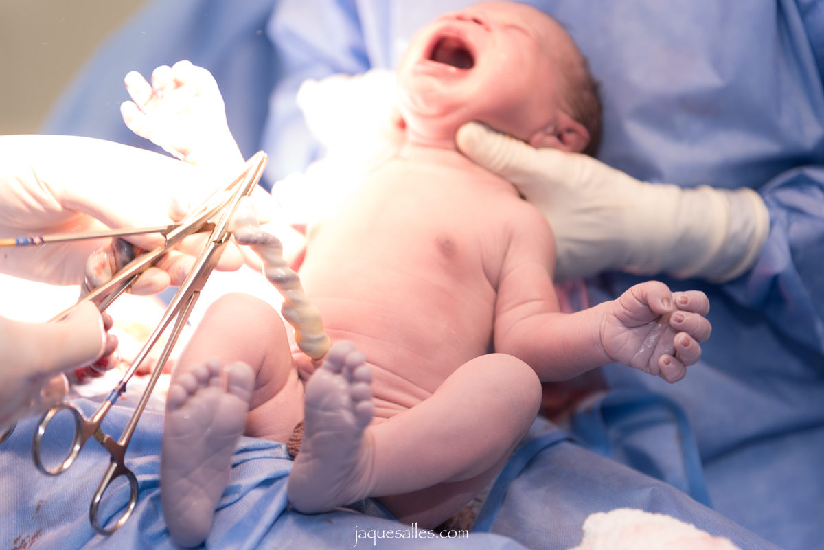 A Import ncia Do Sangue De Cord o Umbilical Criog nesis A Import ncia Do Sangue De Cord o Umbilical Criog nesis